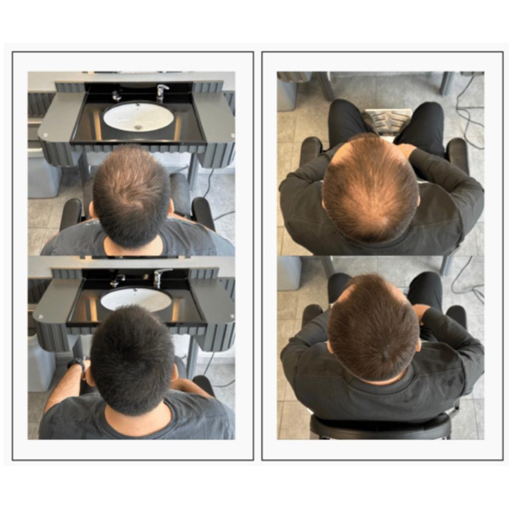 Batci Concealer & Hair Filling Cream | Natural Scalp Concealer for ...