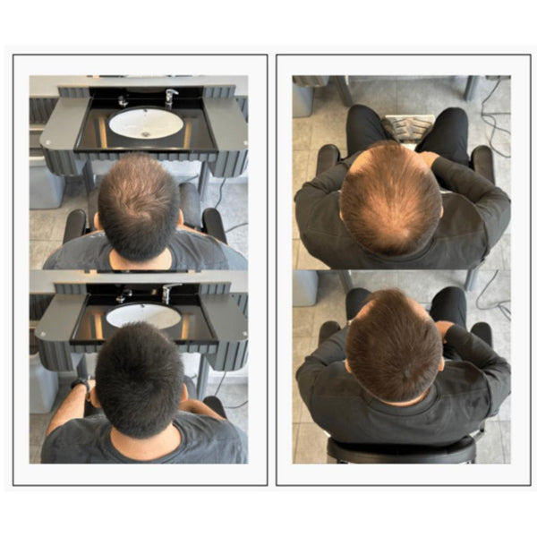 Batci Concealer & Hair Filling Cream | Natural Scalp Concealer for ...